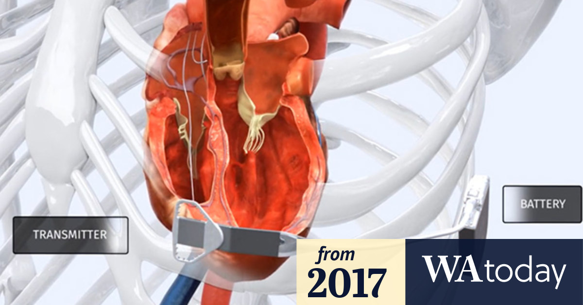 Video: How the WiSE-CRT wireless pacemaker works